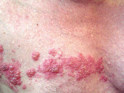 Afecciones Cutáneas